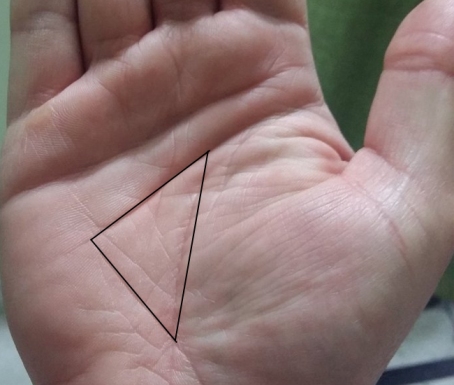 Money Line On Palm: What It Means For You? - InstaAstro